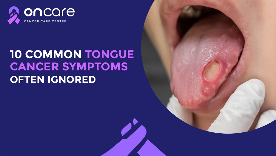 10 Common Tongue Cancer Symptoms You Shouldnt Ignore